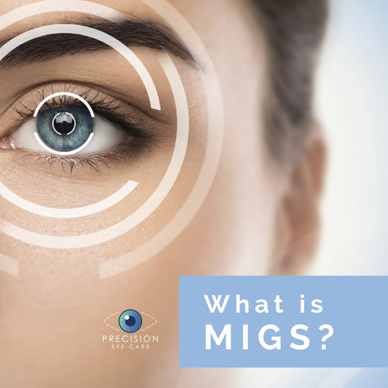 Minimally Invasive Glaucoma Surgery Archives Precision Eye Md