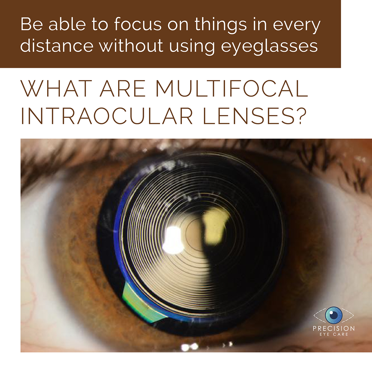 Multifocal Intraocular Lenses Precision Eye Cataract And Laser Eye