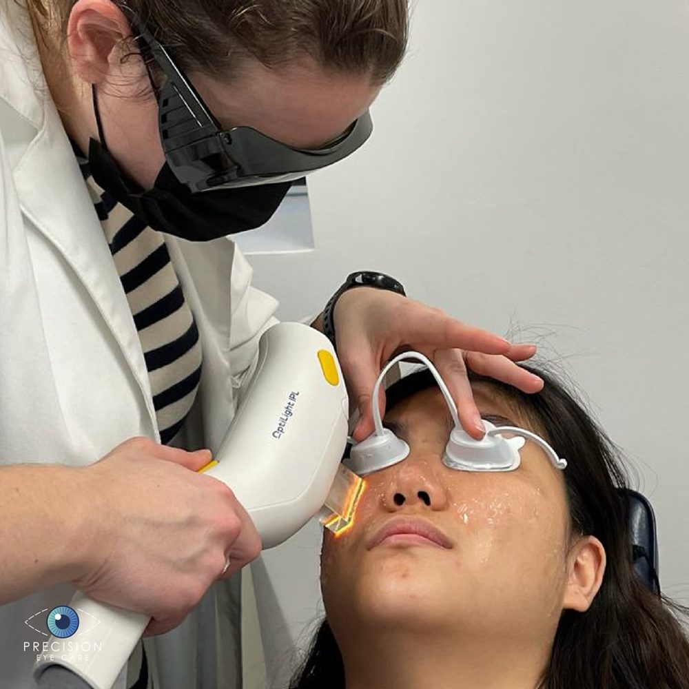 Dry Eye IPL Archives Precision Eye Cataract And Laser Eye Surgery