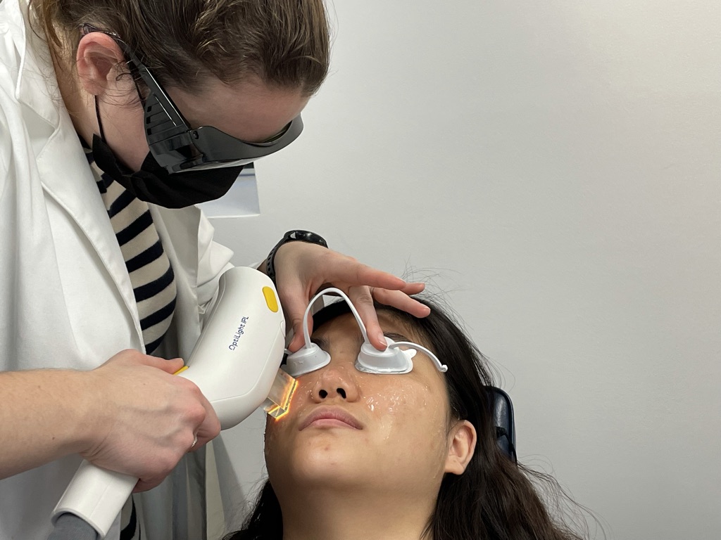 IPL Therapy: Transform Your Skin Today